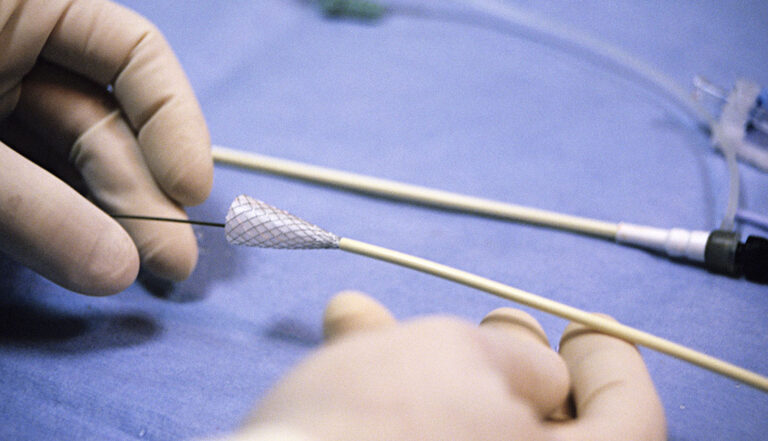 SEMS (Metallic Stents Placement) - Medigenix